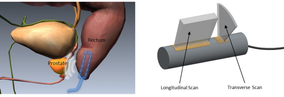 Novel Ultrasound Transducers Arrays For Biomedical Imaging Dr